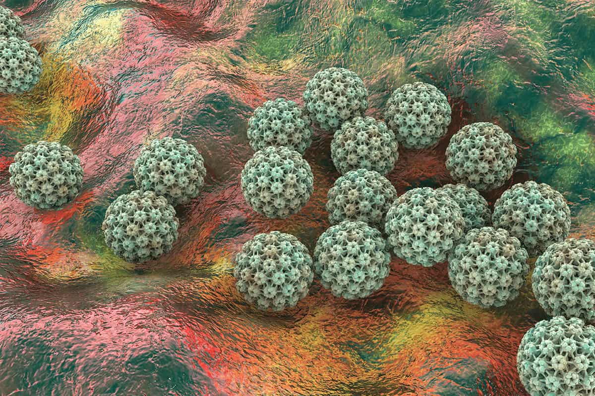 ¿Qué es VPH? Causas, síntomas y tratamiento - Doctor Minded